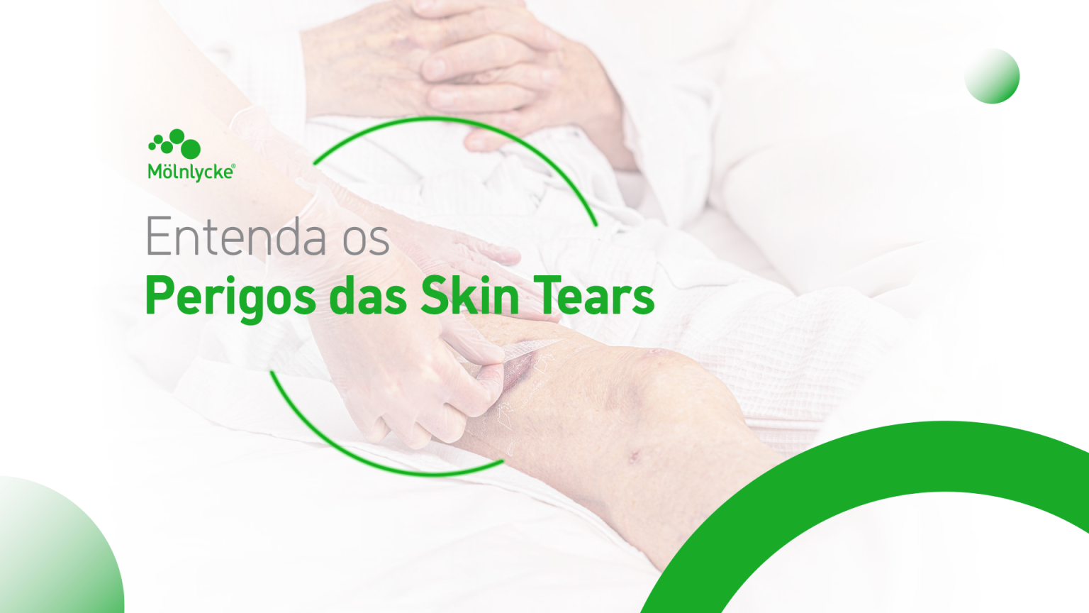 Skin Tears: Entenda os perigos - Mölnlycke